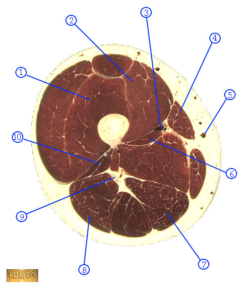 Lower Limb Cross Sections