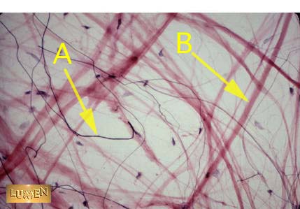 Histology Practical Connective Tissue Proper