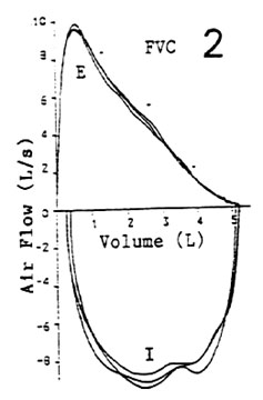 Configuration of expiratory limb: Exponential drop in rate of flow ...