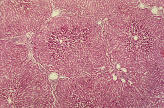 Review of Pathology of the Liver - Lobulation