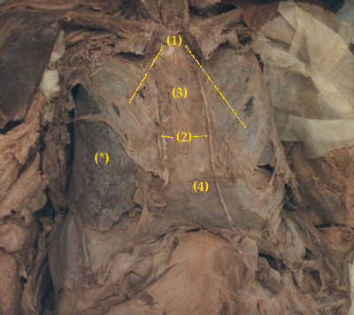 Parietal Pleura Cadaver Pleural Cavity: Anatomy And Clinical Aspects
