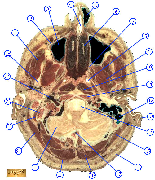 untitled [www.lumen.luc.edu]