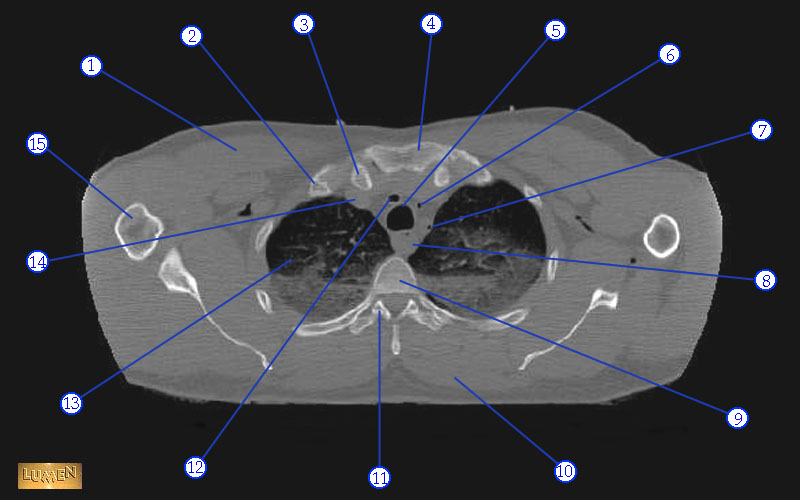 Thorax Cross Section