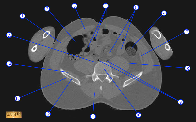 Pelvis Cross Section