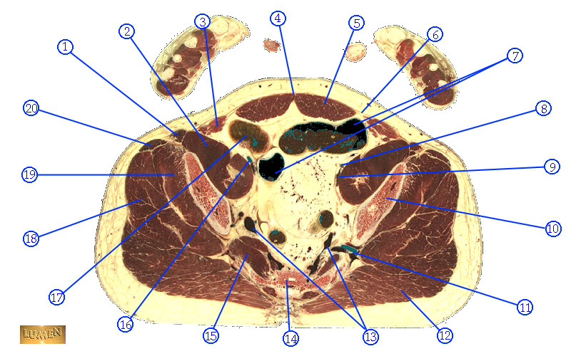 Pelvis Cross Section