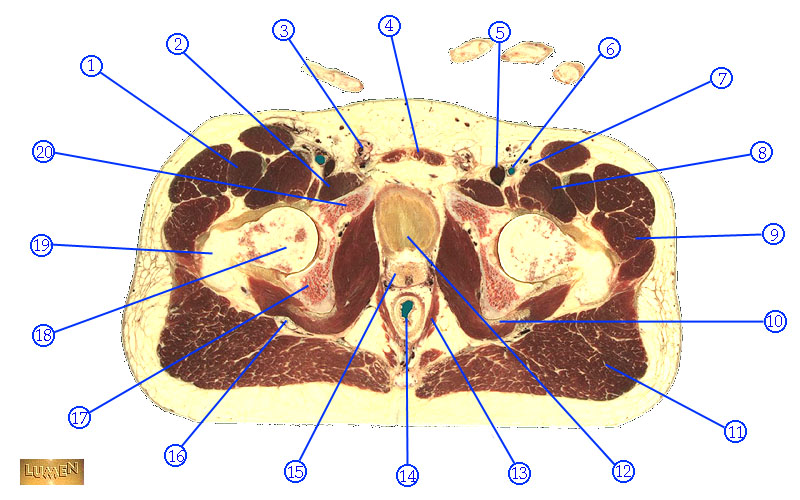 Pelvis Cross Section