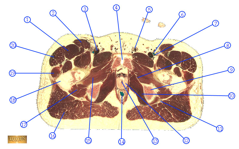 Pelvis Cross Section