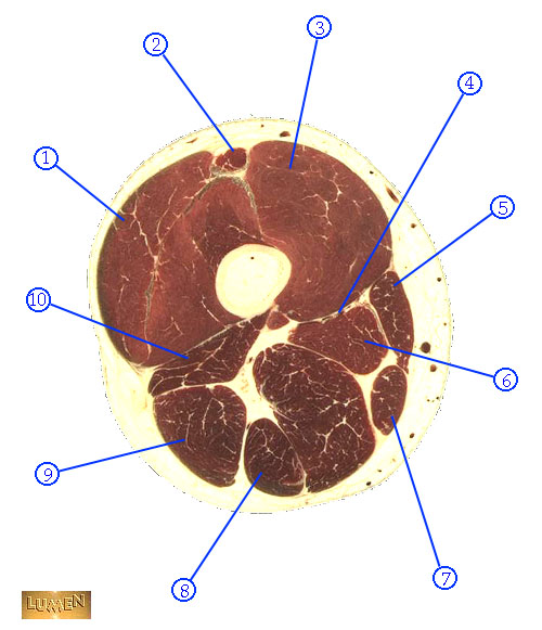 Lower limb cross sections