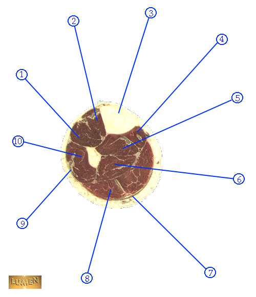 Lower limb cross sections
