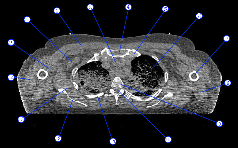 Thorax Cross Section