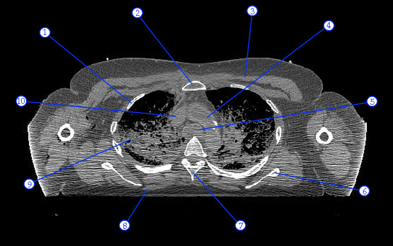 Thorax Cross Section