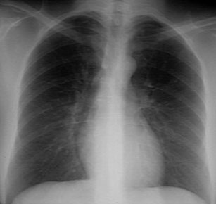 is one of the most important diagnostic tools in evaluating patients ...