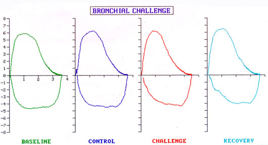 Pulmonary Function Test