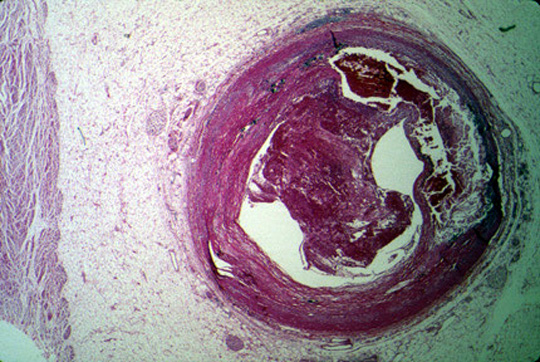 New Page 1 [www.lumen.luc.edu]