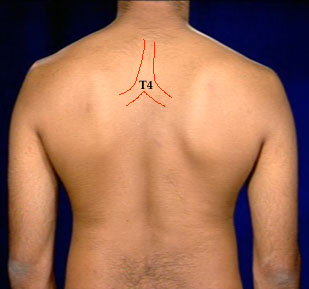 Trachea starts fromcricoidcartilage to sternal angle anteriorly and to ...