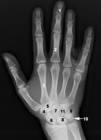 Try to identify the following