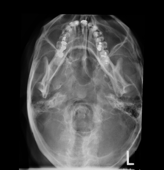 Identify the Sinuses you see. Click on the image to see the labeled image.