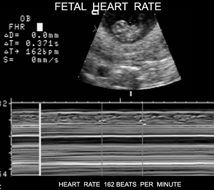 Image Atlas of Normal Pregnancy