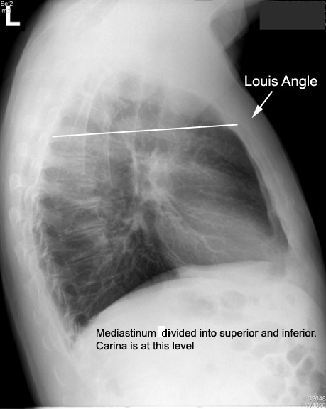 Identify The Sternum And Angle Of Louis What Are The Important
